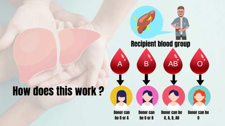 Blood group Compatibility in Liver Transplantation - Dr Sunil Shenvi ...